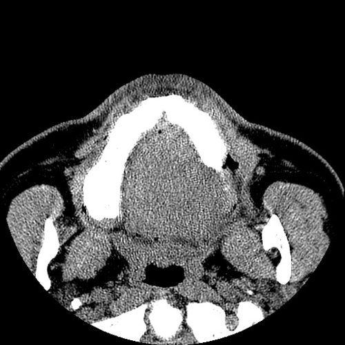 dentascan - Dental, Orthodontic, Maxillofacial CTs - embodi3D.com