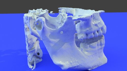 Bone 3D printing - stl file processed - Dental, Orthodontic ...