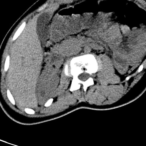 Spine - Thorax CTs - embodi3D.com