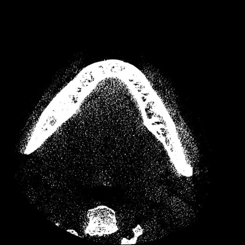 Ct scan jaws - Dental, Orthodontic, Maxillofacial CTs - embodi3D.com