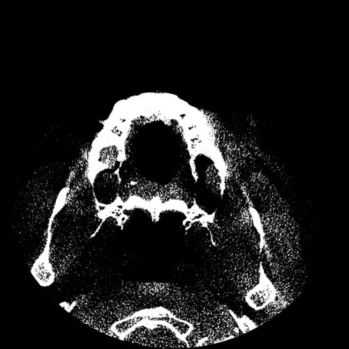 Ct scan jaws - Dental, Orthodontic, Maxillofacial CTs - embodi3D.com