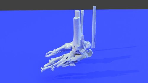CT Scan - stl file processed - Extremity, Lower (Leg) - embodi3D.com