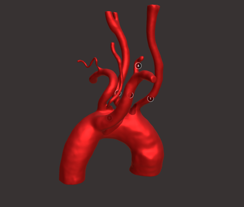 Aortic Arch with Arteria Lusoria - Aorta - embodi3D.com