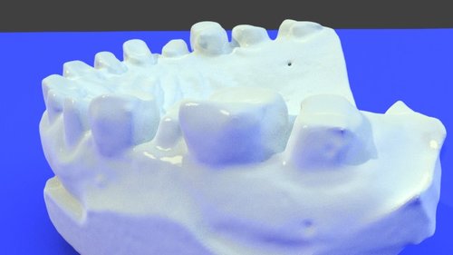Cast model - stl file processed - Dental, Orthodontic, Maxillofacial ...