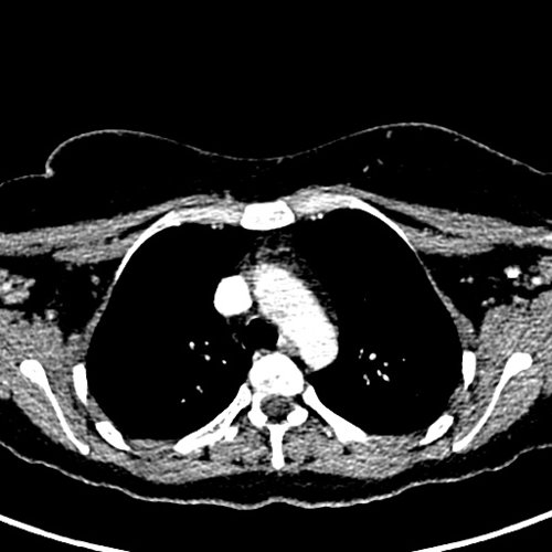 maxfax august - Skull, Head, and Neck CTs - embodi3D.com