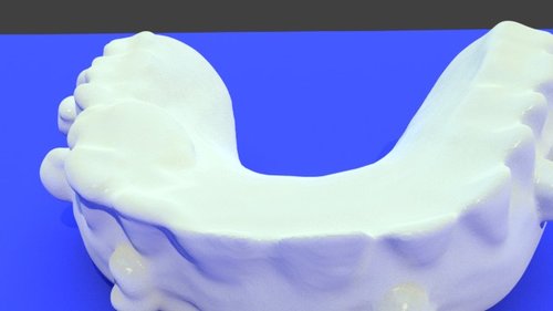 denture - stl file processed - Dental, Orthodontic, Maxillofacial ...