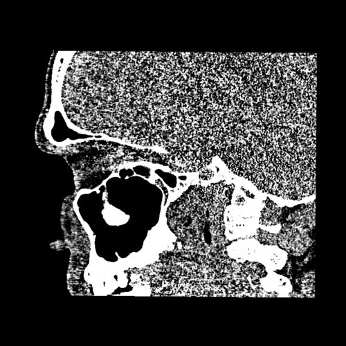 Sinus scan - Dental, Orthodontic, Maxillofacial CTs - embodi3D.com