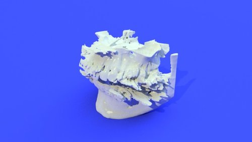 Dental 3D file - stl file processed - Dental, Orthodontic ...