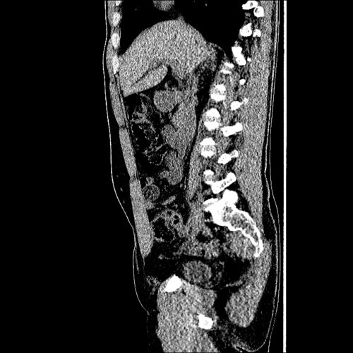 Lumbar CT - Spine CTs - embodi3D.com