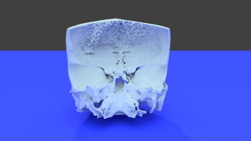 Very Detailed Bone - Ultra - stl file processed - Dental, Orthodontic ...