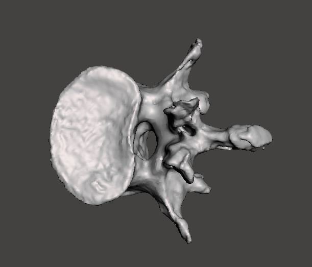 spine - Whole Body CTs - embodi3D.com