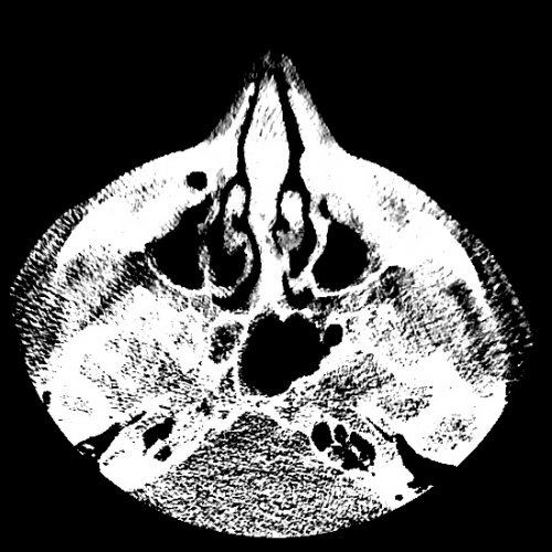Maxillofacial area - Dental, Orthodontic, Maxillofacial CTs - embodi3D.com