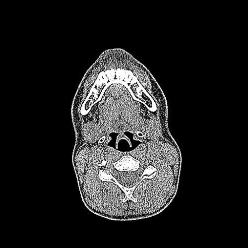 Head_CT_Bone_pediatric - Skull, Head, and Neck CTs - embodi3D.com