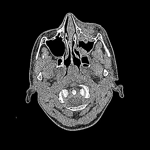 Head_CT_Bone_pediatric - Skull, Head, and Neck CTs - embodi3D.com
