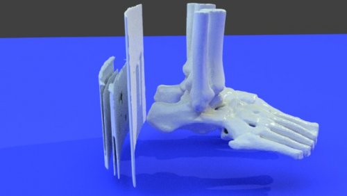 leg model - stl file processed - Extremity, Lower (Leg) - embodi3D.com