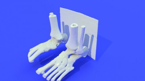 leg model - stl file processed - Extremity, Lower (Leg) - embodi3D.com