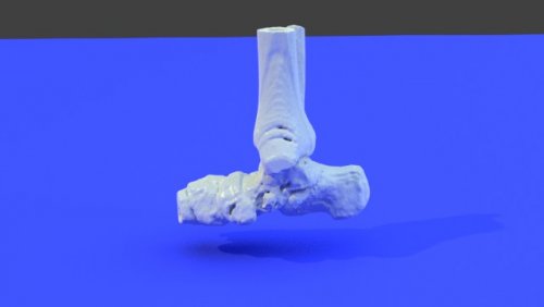 leg model - stl file processed - Extremity, Lower (Leg) - embodi3D.com