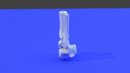 leg model - stl file processed - Extremity, Lower (Leg) - embodi3D.com