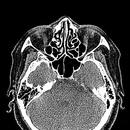 cbct - Skull, Head, and Neck CTs - embodi3D.com