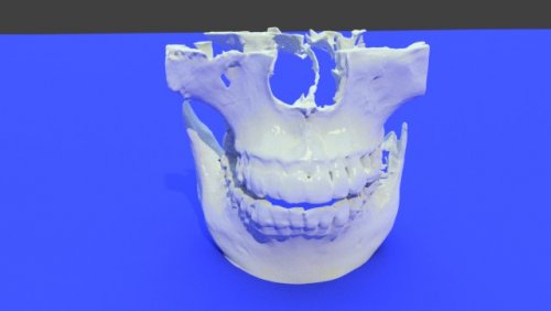 teeth - stl file processed - Dental, Orthodontic, Maxillofacial ...