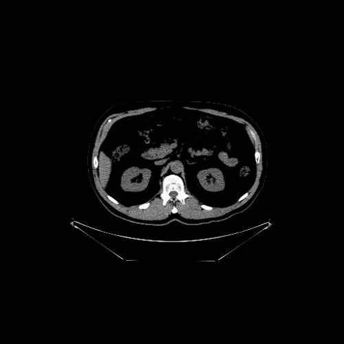 full body bone CT - Whole Body CTs - embodi3D.com