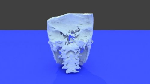 Dental model - stl file processed - Dental, Orthodontic, Maxillofacial ...