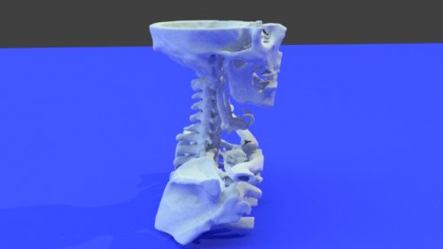neck - stl file processed - Skull and Face - embodi3D.com