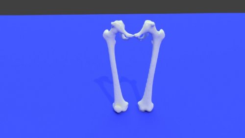 femur 1 v1 - stl file processed - Extremity, Lower (Leg) - embodi3D.com