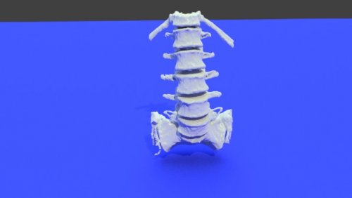 Coronal Bone - stl file processed - Spine and Pelvis - embodi3D.com