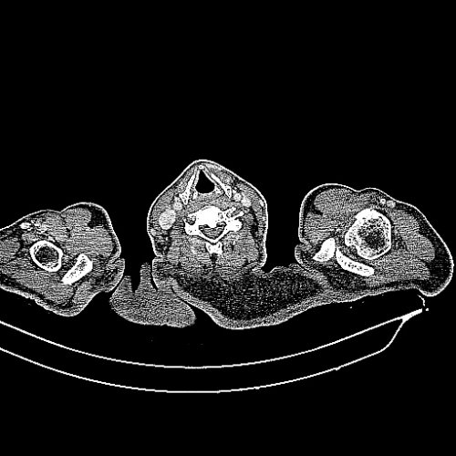 ct scan whole body - Abdomen and Pelvis CTs - embodi3D.com