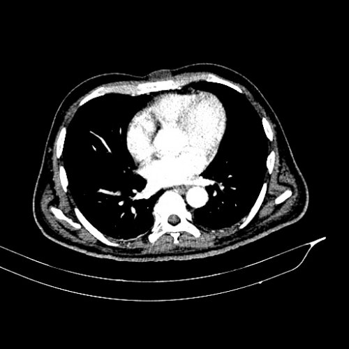 ct scan whole body - Abdomen and Pelvis CTs - embodi3D.com