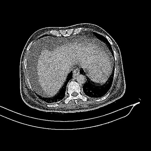 ct scan whole body - Abdomen and Pelvis CTs - embodi3D.com