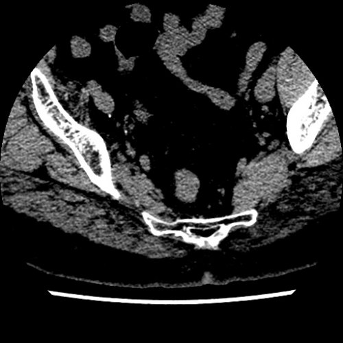 mri - Spine CTs - embodi3D.com