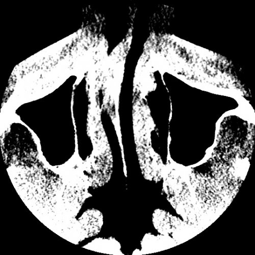 Jaw Scan - Dental, Orthodontic, Maxillofacial - embodi3D.com