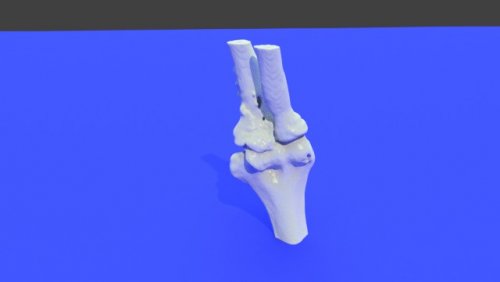 elbow rotatory instability - stl file processed - Extremity, Upper (Arm ...