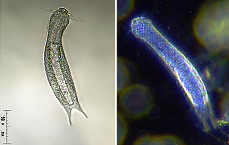 Gastrotrichs - Encyclopedia of Arkansas
