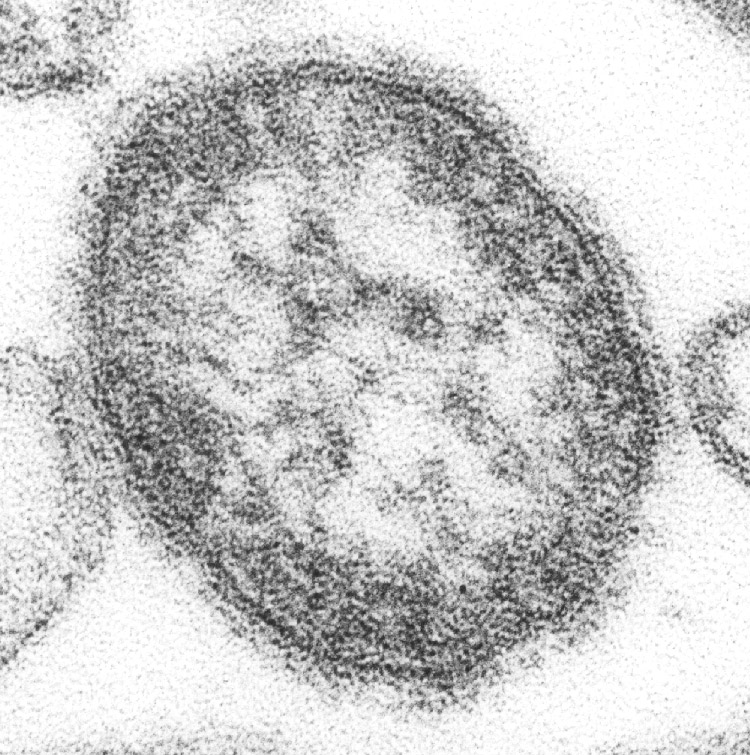 Measles Virus - Encyclopedia of Arkansas