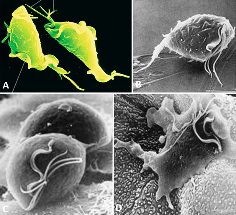 Trichomonas - Encyclopedia of Arkansas