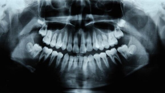 New Study Indicates Humans May Be Able to Grow a Third Set of Teeth ...