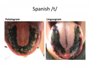 A Learner’s Guide to Static Palatography – Charcoaland: a site by ...