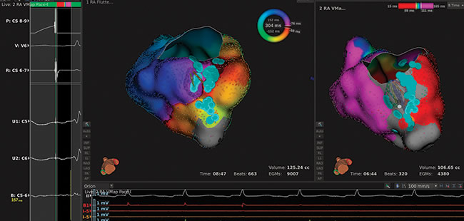 3-D Mapping | Cardiac Care - Florida Trend