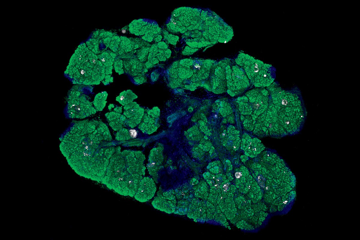 Engineering a Solution to Cancer - Florida Trend | Feature