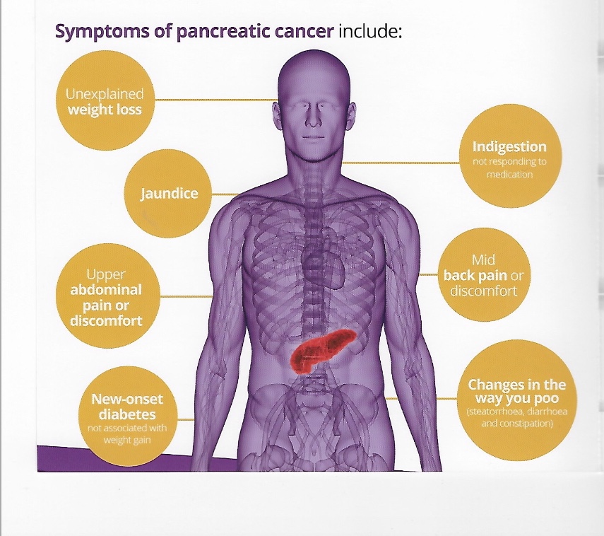 Spotting the symptoms of pancreatic cancer