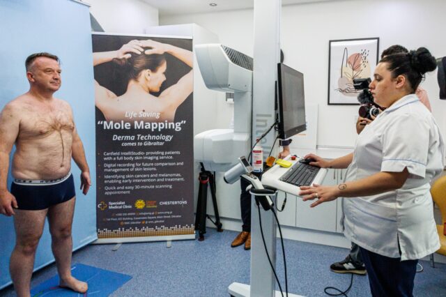 ‘Mole mapping’ kit helps early detection of skin cancer, generating ...