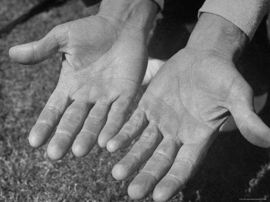 Calluses on hands - Instruction & Academy - GolfWRX