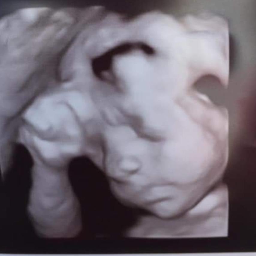 GiveSendGo - Colston Family : The #1 Free Christian Fundraising Site.