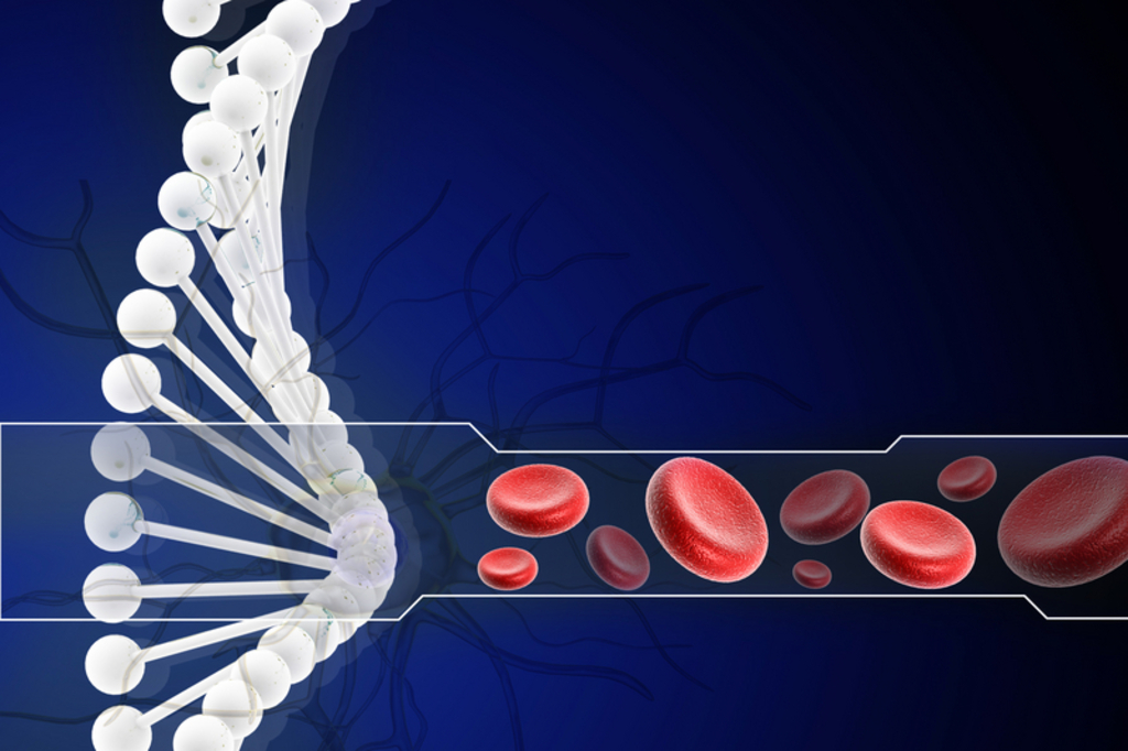 Spherocytosis Pronunciation