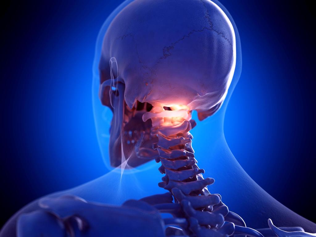 CIRS, Dysautonomia and Upper Cervical Care