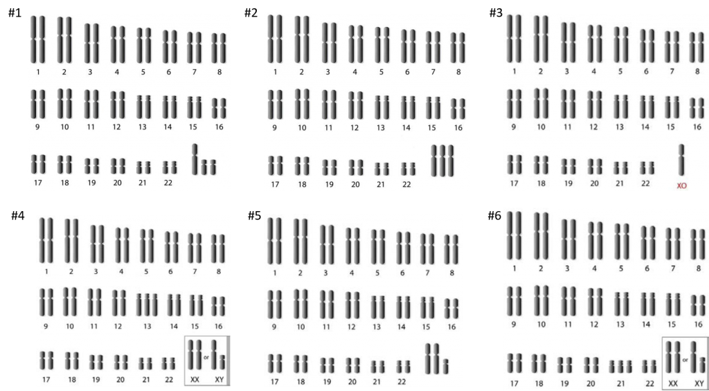 SOLUTION: Moraine Valley Community College Genetic Screening Phenotype ...