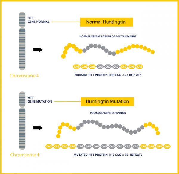 Huntington’s Disease Research: Shutting down the mutant gene ...